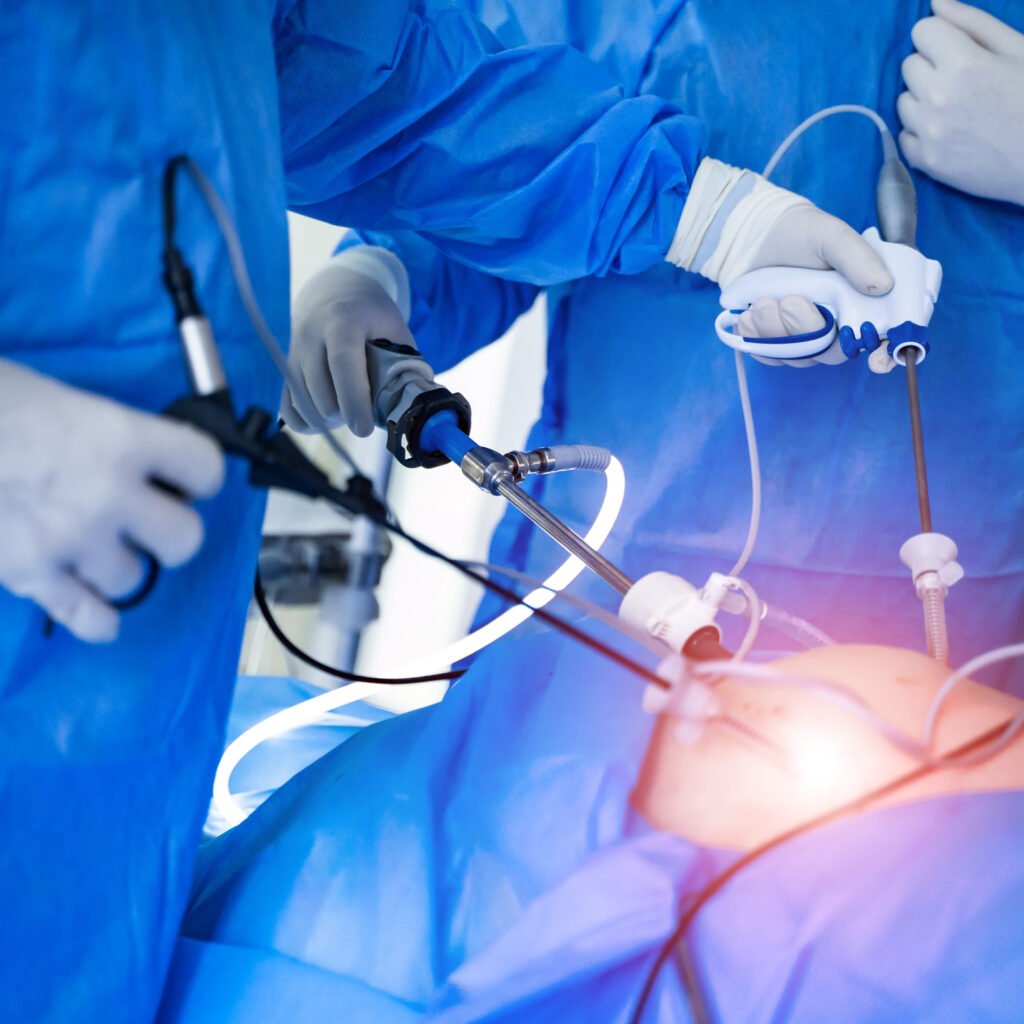 Laparoscopic Gastrointestinal Surgery | Dr. Shrikant Kurhade