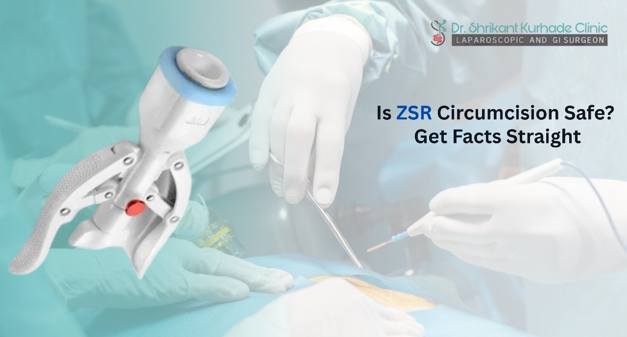 Is ZSR Circumcision Safe? Get Facts Straight - Dr Shrikant Kurhade