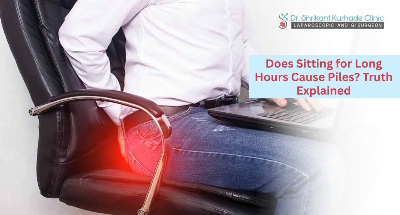Does Sitting Long Hours Cause Piles? Truth Revealed